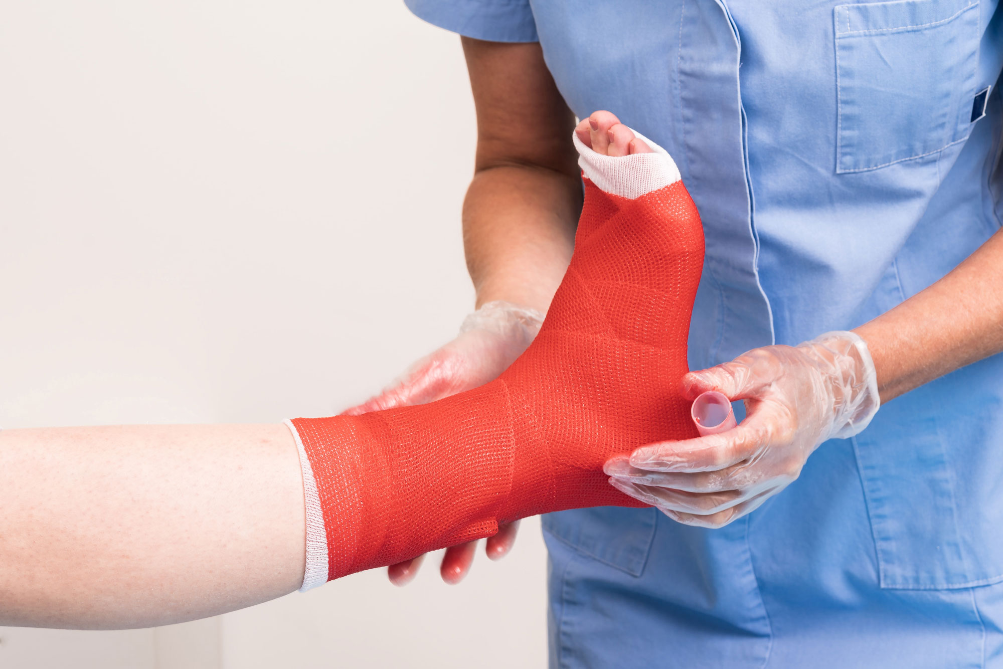 Plaster cast care (ကျောက်ပတ်တီးစည်းခြင်း) - CLL HEALTH